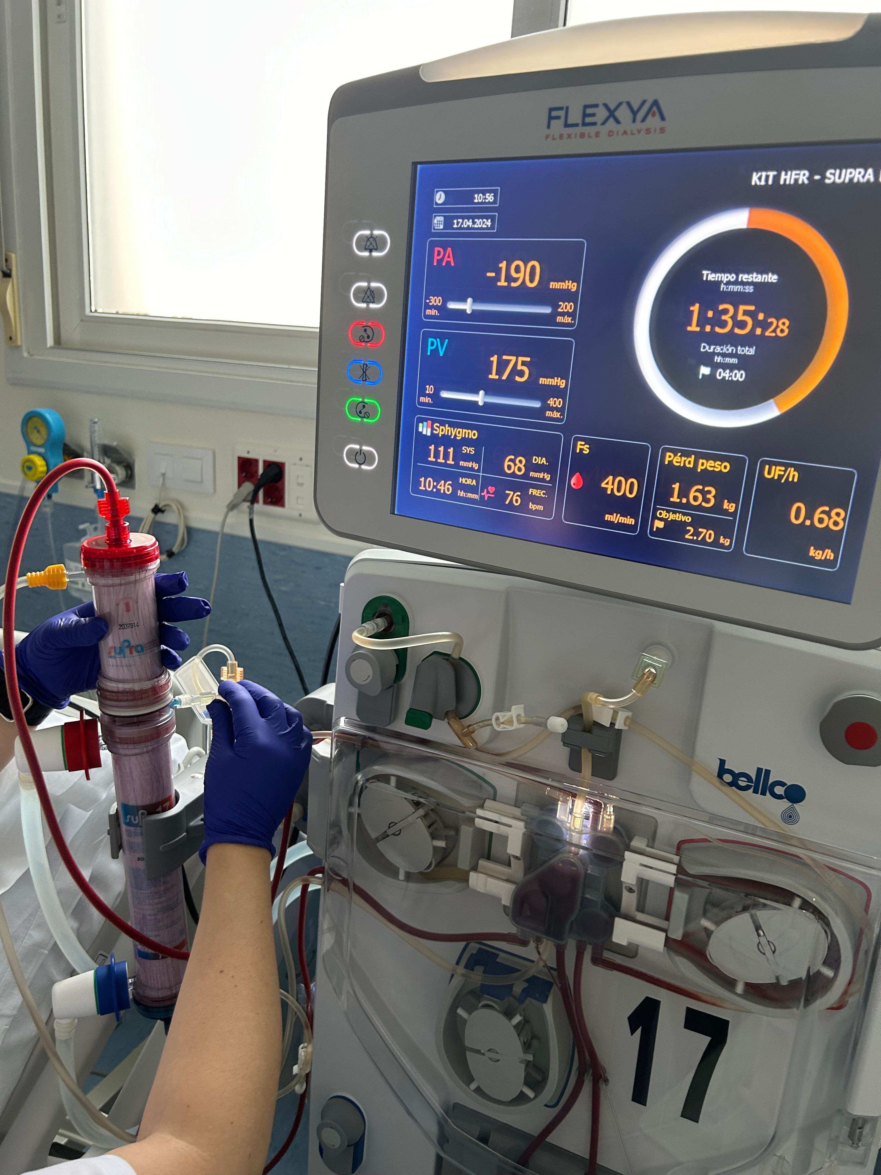 Curso Teórico - Práctico de Enfermería de Hemodiálisis, Diálisis ...